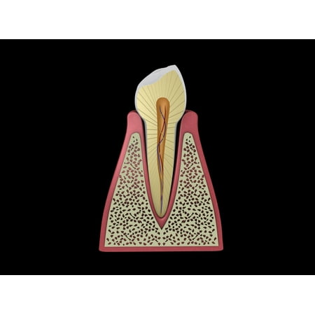 Conceptual image of human tooth Poster Print (32 x 24) | Walmart Canada
