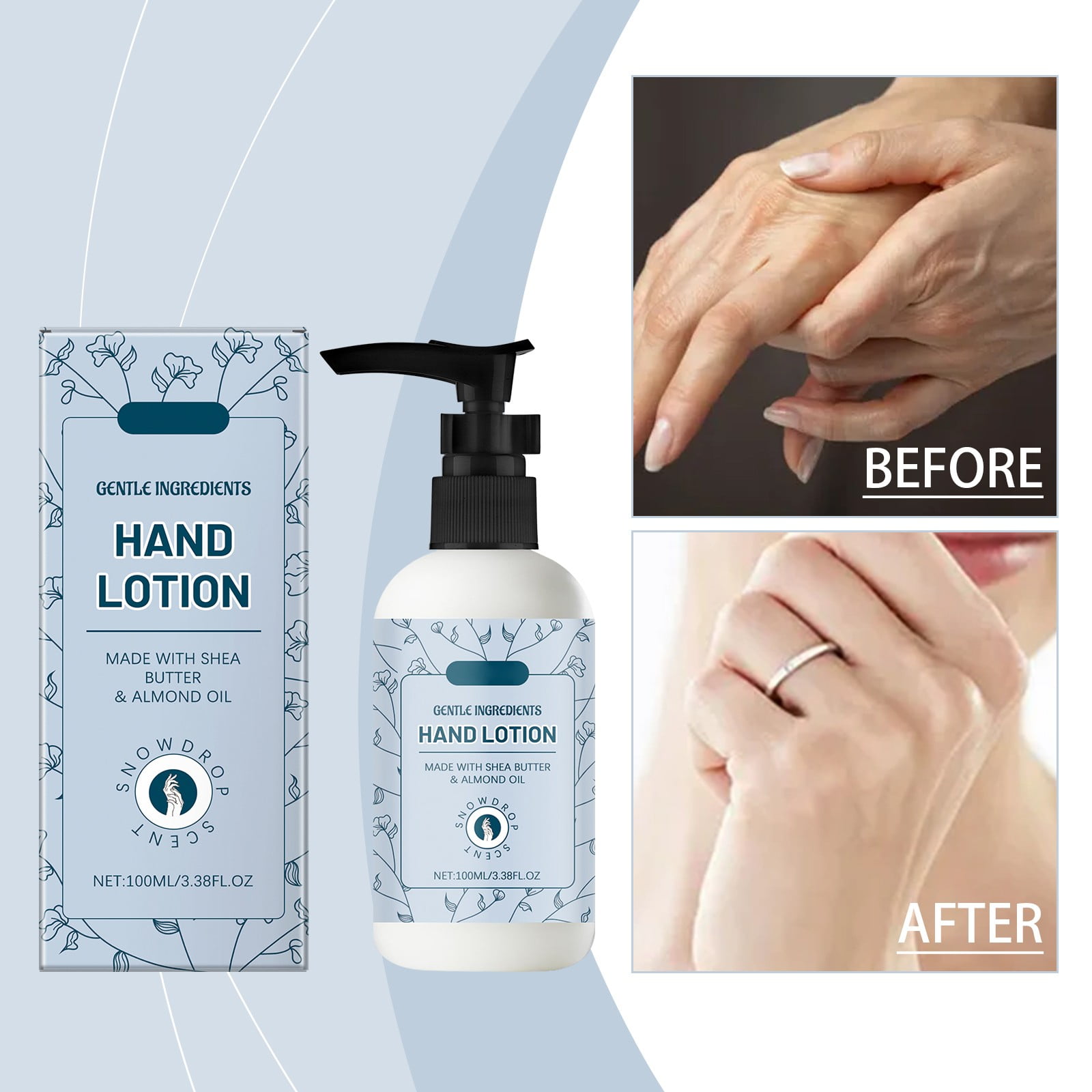 Ordinary Skin Care Products Nourishing Hand Skin Hand Lotion Improves ...