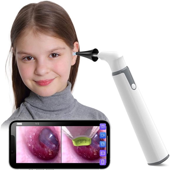 Ear Scope Camera
