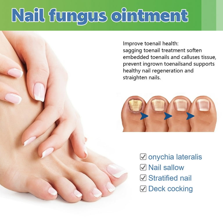 Onychia And Paronychia Of Toe