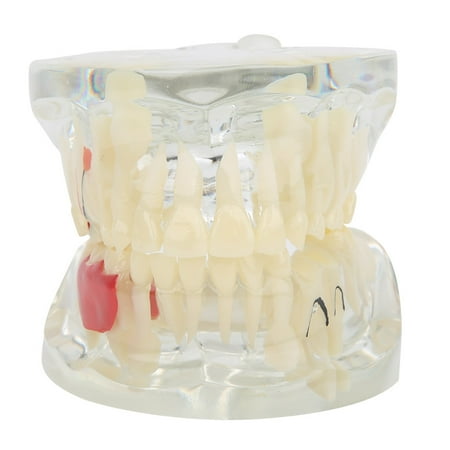 Teeth Models, Teeth Study Teaching Model, Students' Learning Tool Tooth ...