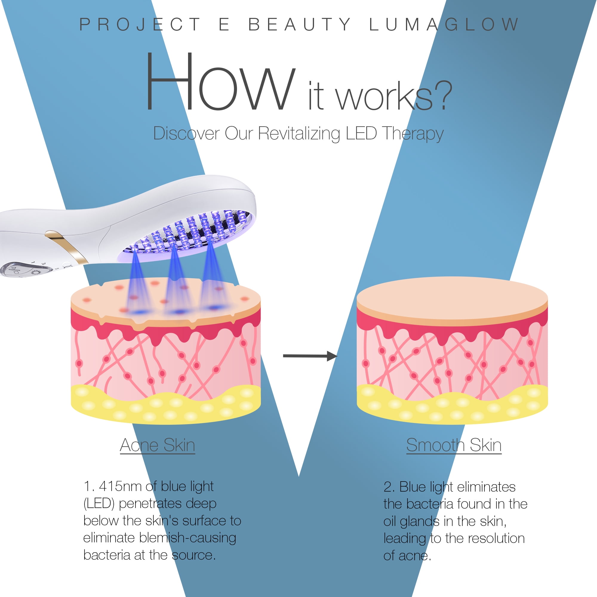 Buy Project E Beauty LumaGlow Blue LED Light Therapy | Anti Acne ...