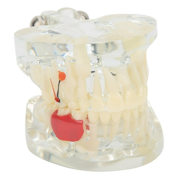 Teeth Study Teaching Model, Transparent Resin Tooth Row Model Teeth ...