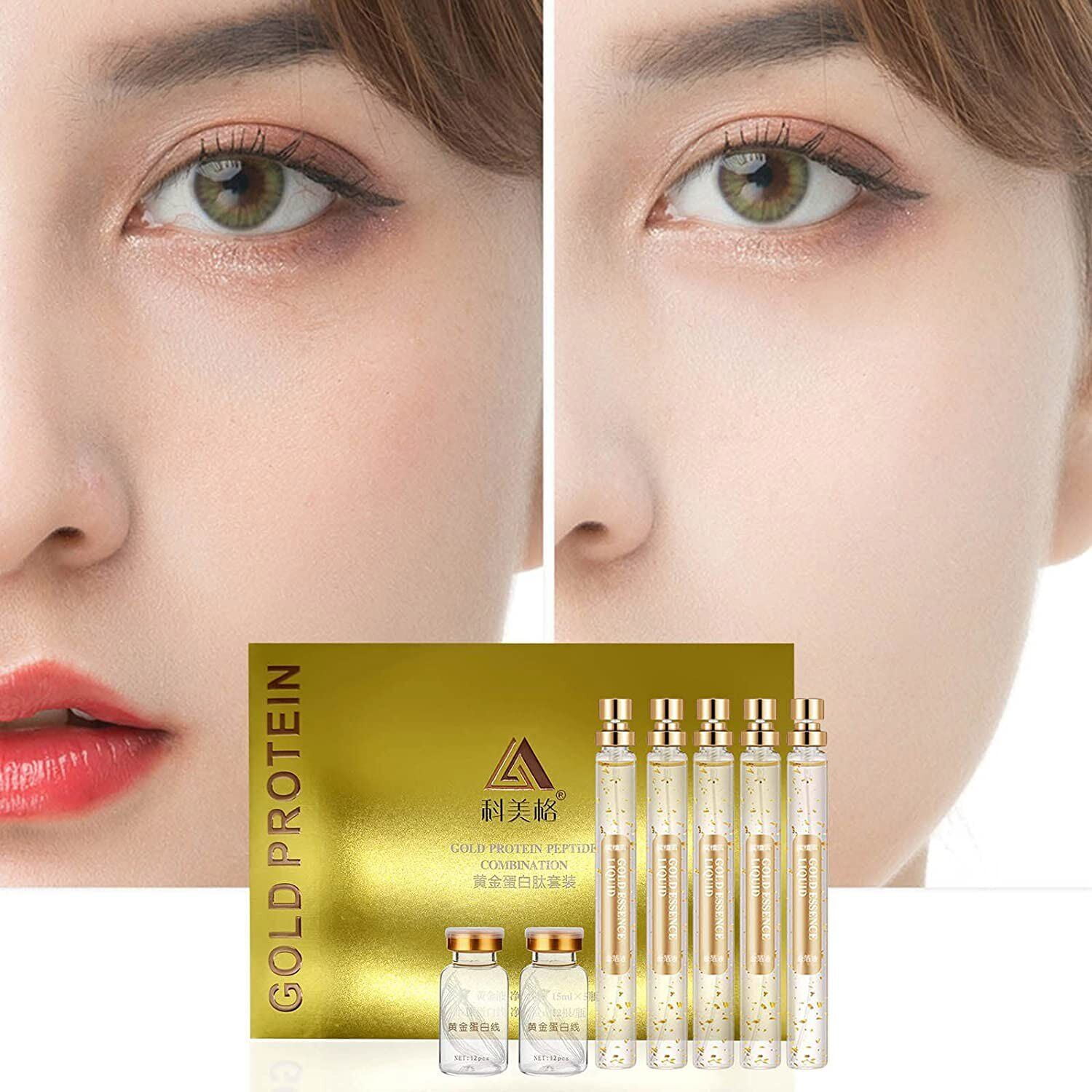 Buy Protein Thread Lifting Set, Soluble Protein Thread and Nano Gold ...