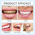 Teeth Whitening,Teeth Whitening Kit,Instant Teeth Whitening Paint Pen ...