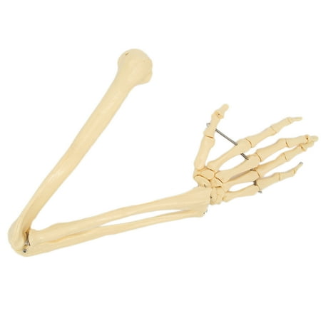 Upper Limb Bone Model, Anatomical Arm Bone Model Durable For Doctor ...