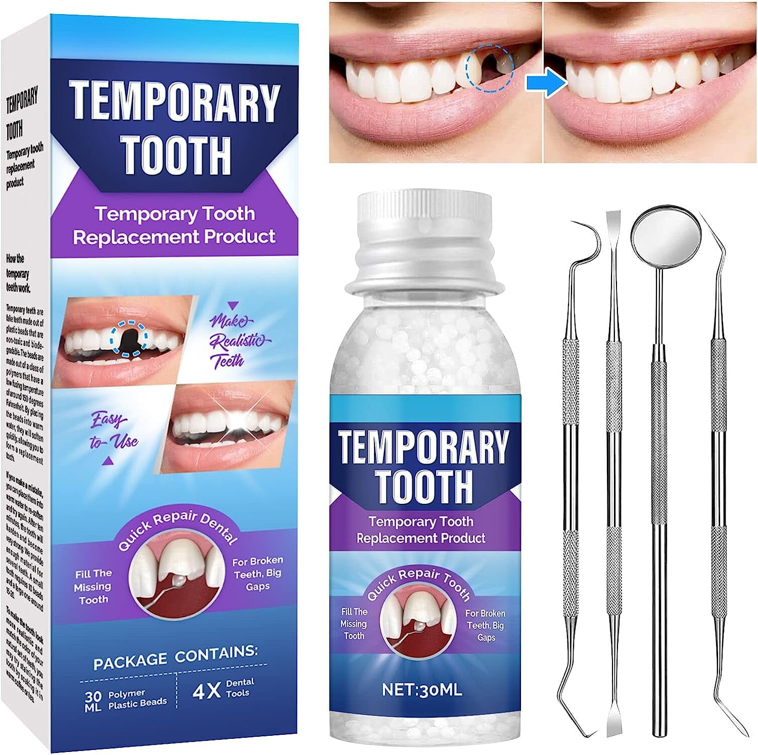 Repair Tooth Kit