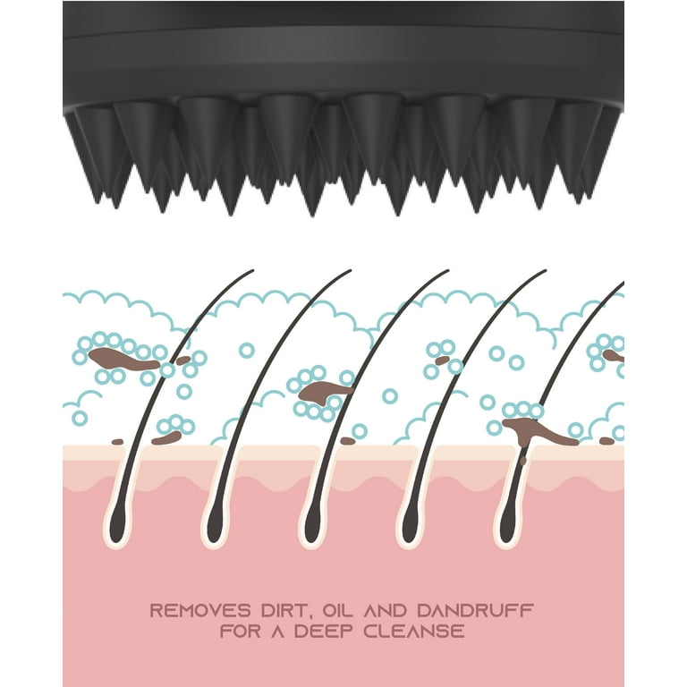 Dandruff Scalp Diagram