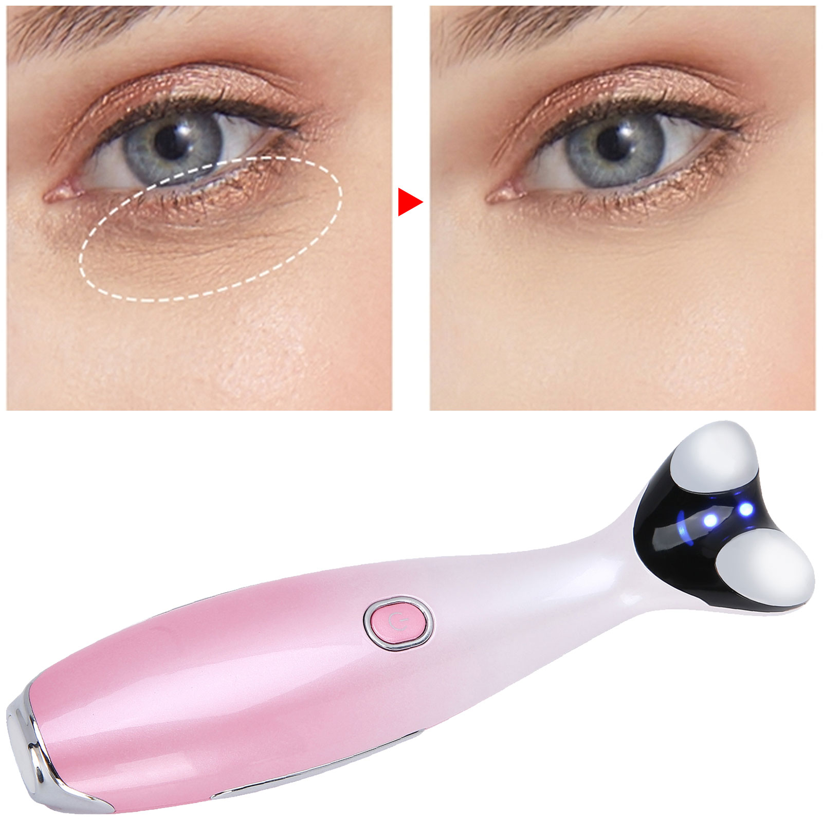 Sonew RF LED Light Photon Facial Eyes Wrinkle Removal Skin Lift Tighten ...