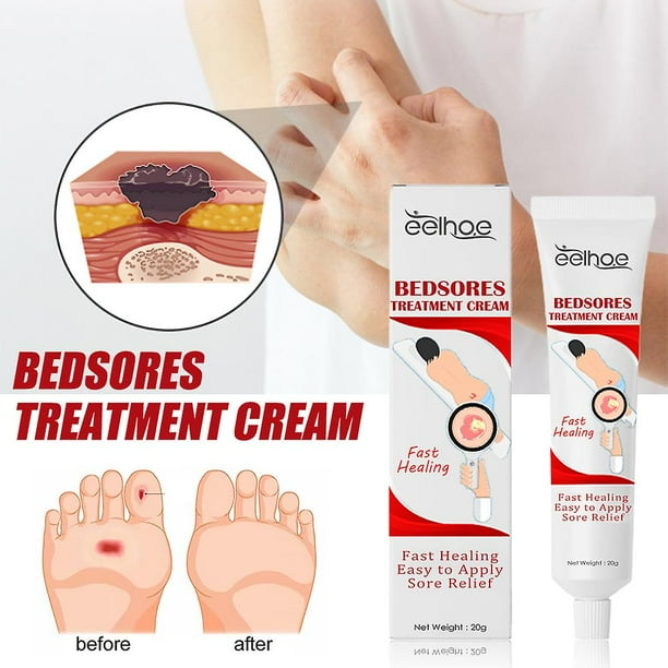 Bed Sore Treatment Cream Bedsore Ointment Bed Sores Fast Wound Healing ...