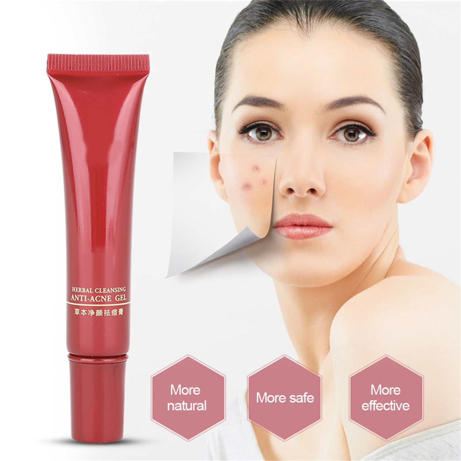 Gel Para Eliminar Marcas De Acné Y Cicatrices De 15 G, Crema Para El ...