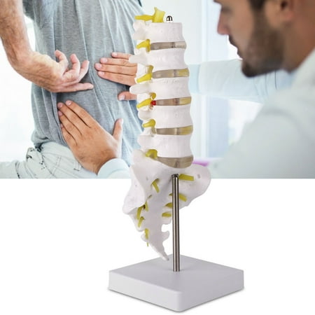 YLSHRF Lumbar Teaching Model,Lumbar Vertebral Spine Model Human Lumbar ...