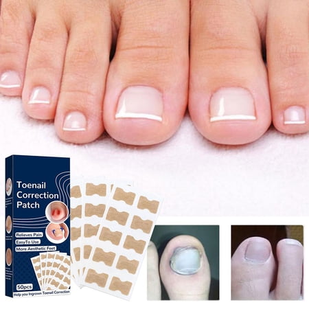 50 Pcs Ingrown Toenails Patch Sticker Toenail Patch Corrector Pedicure ...