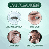 2 PACKS Anti-mite eye wipes | for itchy eyes, dry eyes, stye and ...