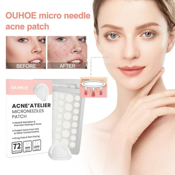 Parche para el acné Parches transparentes para espinillas para ...