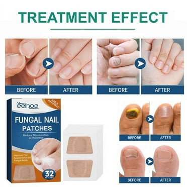 Pacific World Sensationail Essentials Kit, 1 ea - Walmart.com