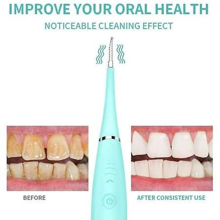 Plaque Remover For Teeth, Dental Cleaning Plaque Removal Kit, Oral Care ...