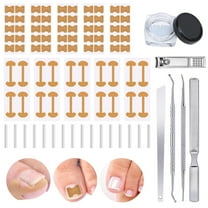 Ingrown Toenail Corrector Strips, Breathable Curved Nail Correction ...