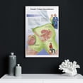 Anatomical Poster Female Urinary Incontinence Posters Wall Art Poster ...