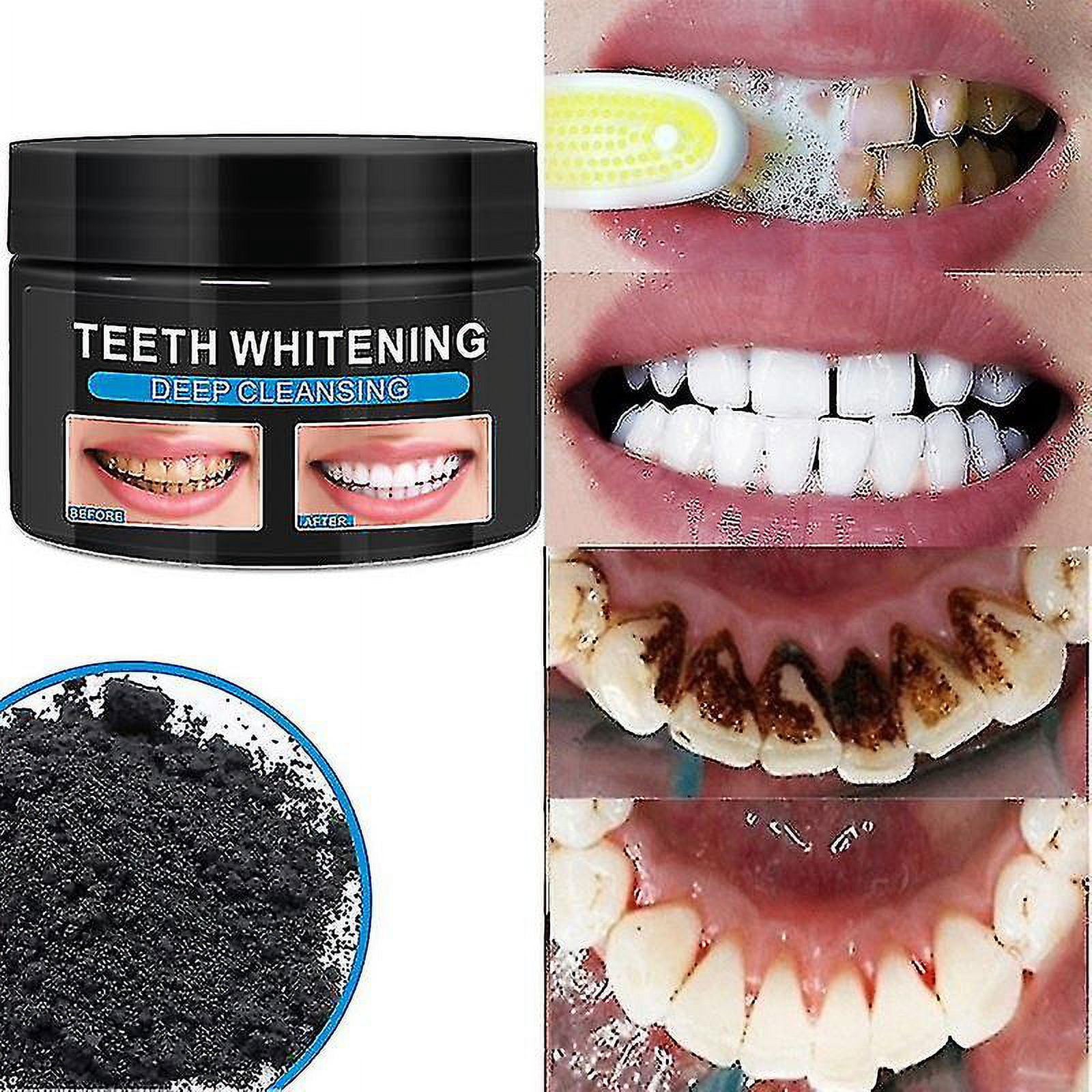 60g Activated Carbon Teeth Whitener Powder Remove Dental Plaque Yellow ...