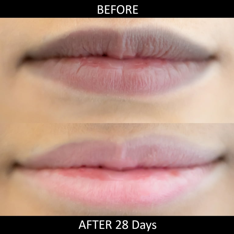 Black Chapped Lips