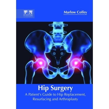Total Hip Replacement: Techniques and Complications (Hardcover ...