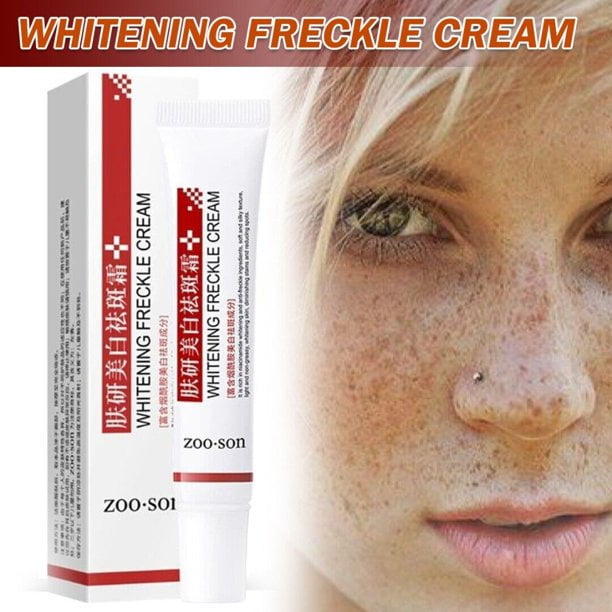 Buy JFYIG Melasma and Freckle Cream Freckle Cream Remove Dark Spots ...
