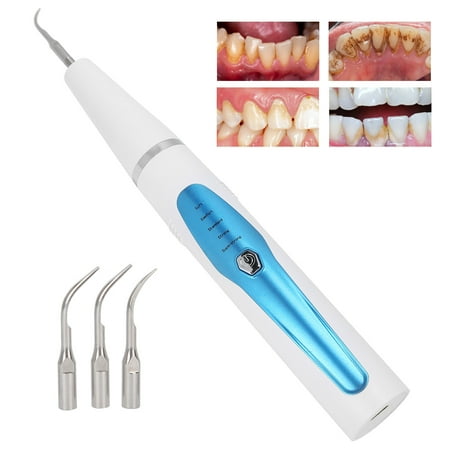 LAFGUR Portable Calculus Remover Scaling Tooth Stains Cleaning ...