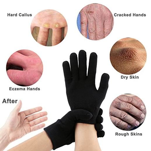 Gloves For Dry Cracked Hands