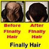 Finally Hair Refill Bag Premium Hair Fibers (Medium Brown) (2oz ...