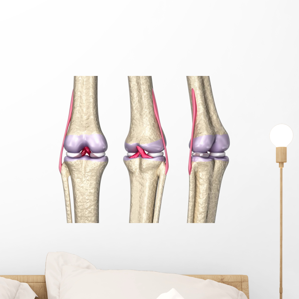 Knee Joint Anatomy 3D Wall Mural Decal Sticker, Wallmonkeys Peel ...