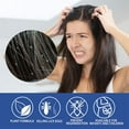 2pcs South Moon Head Lice Removal Spray Hair Removes Lice And Fleas