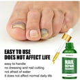 3 Pack Foot Fungus Treatment, Athletes Foot Cream , Kills Fungus On ...