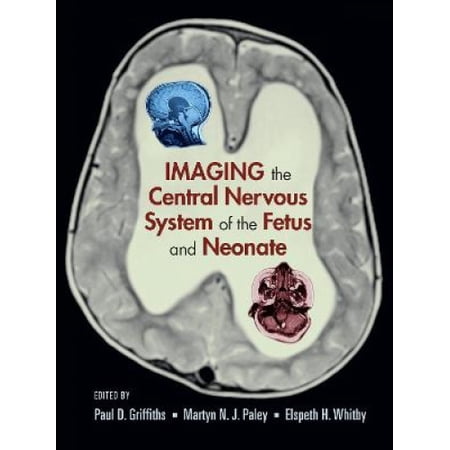 Imaging the Central Nervous System of the Fetus and Neonate | Walmart ...