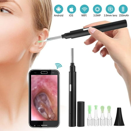 Visual Ear Speculum Hd Ear Scoop Otoscope Ear Wax Cleaning Smart Ear ...