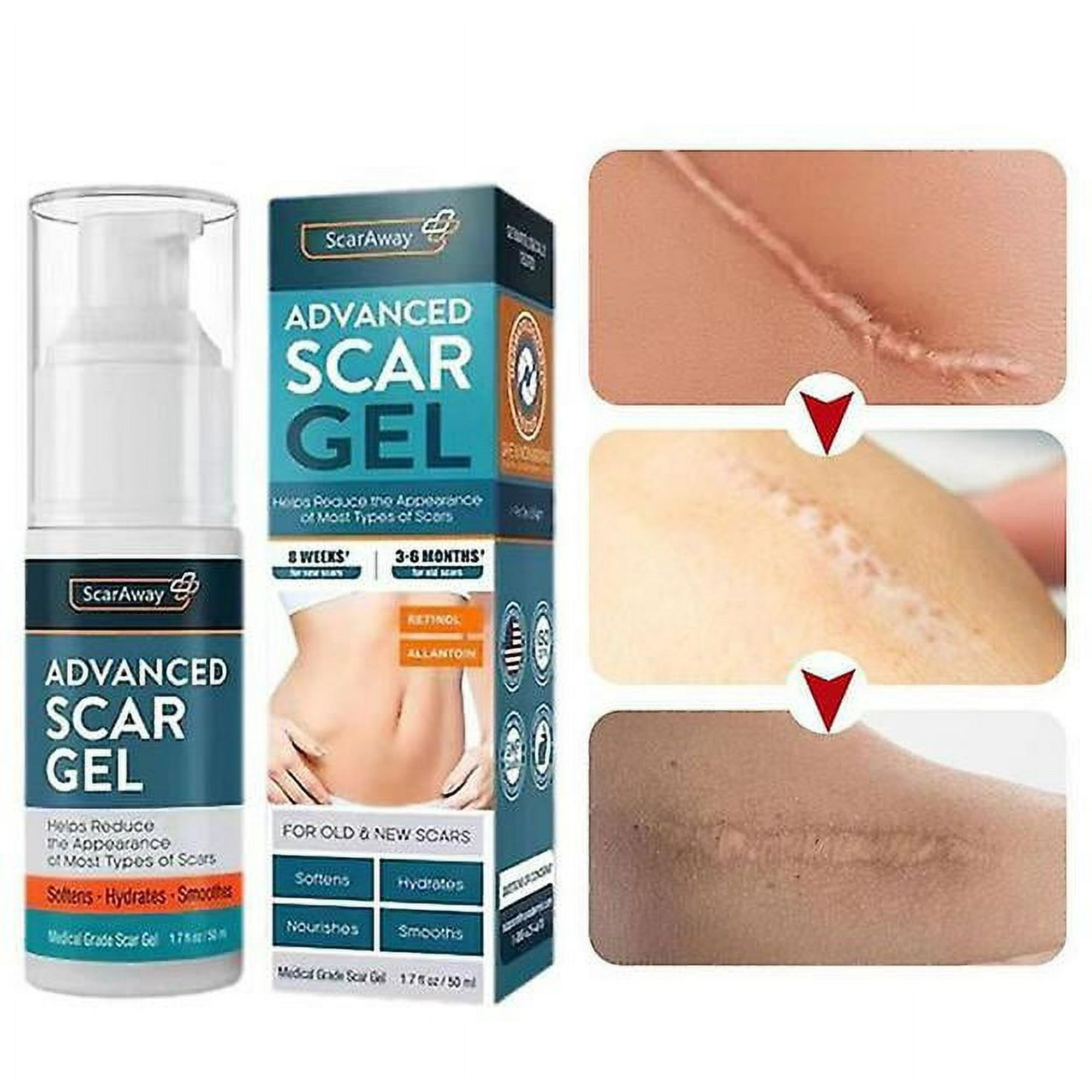 Click here for Other 3x Scaraway Advanced Scar Gel 30ml 30 Ml prices