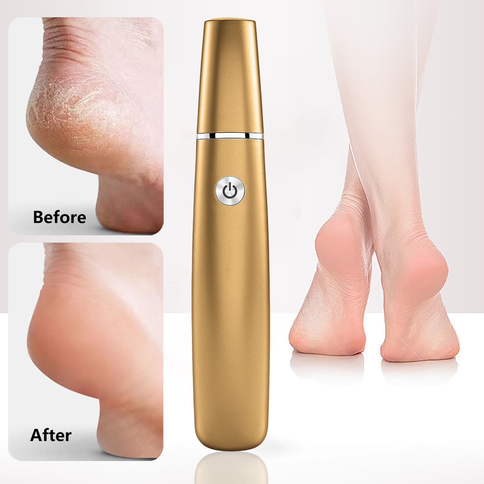 Click here for Blaxill Electric Foot File Callus Remover Recharge... prices