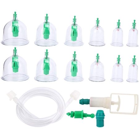Cupping Set, Professional Chinese Acupoint Cupping Therapy ...