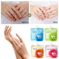 Severe Dry Hands Say Yes To Cucumbers Moisturizer Rough And Bumpy Skin Lotion New Mom Dry Lotion