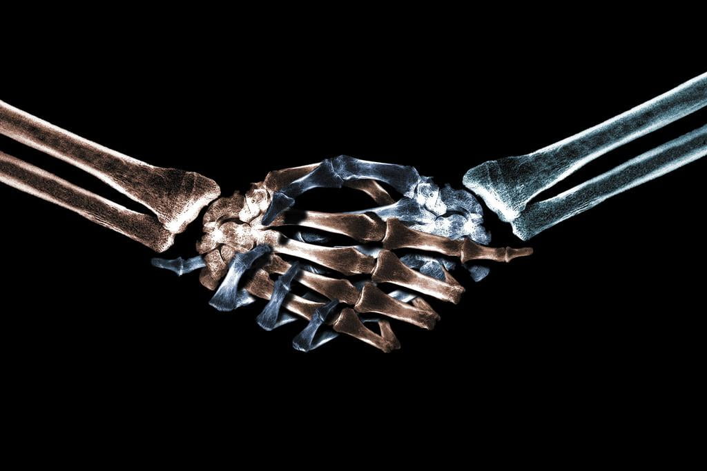 Handshake Skeletons Shaking Hands XRay Photo Poster X Ray Skeleton Arms ...