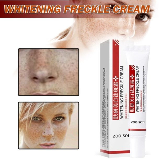 Buy JFYIG Melasma and Freckle Cream Freckle Cream Remove Dark Spots ...