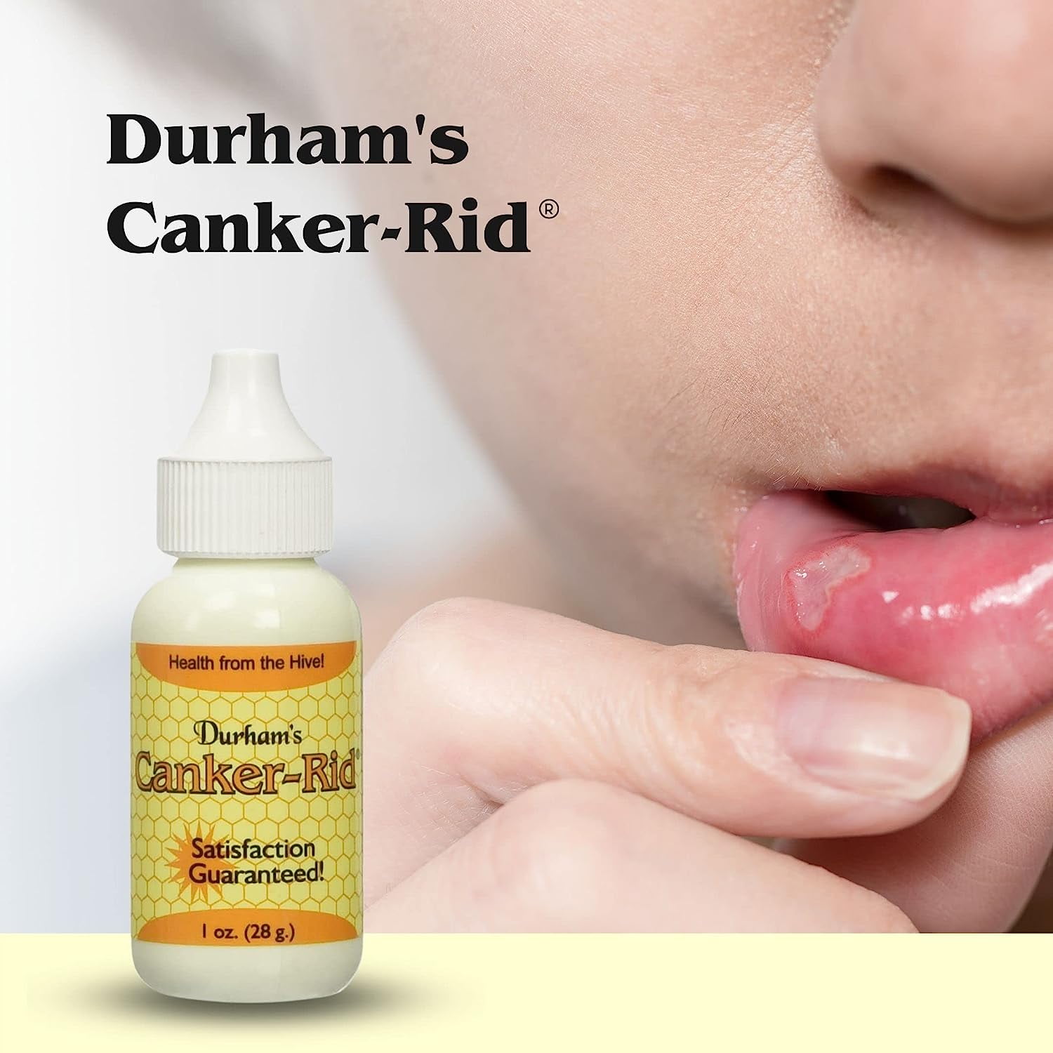 Healing Canker Sore