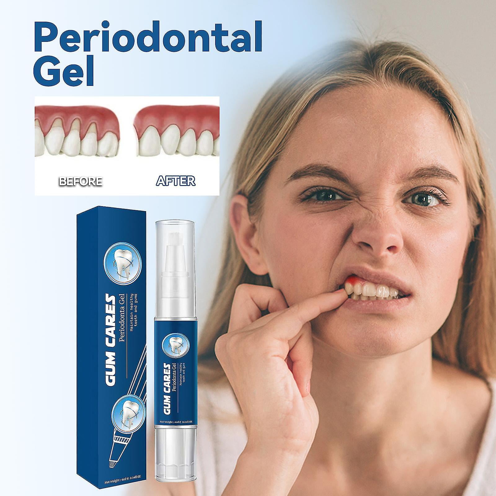 Gum Therapy Gel, Deep Cleaning Tooth Stains, Tartar, Sore Gums, Gum ...