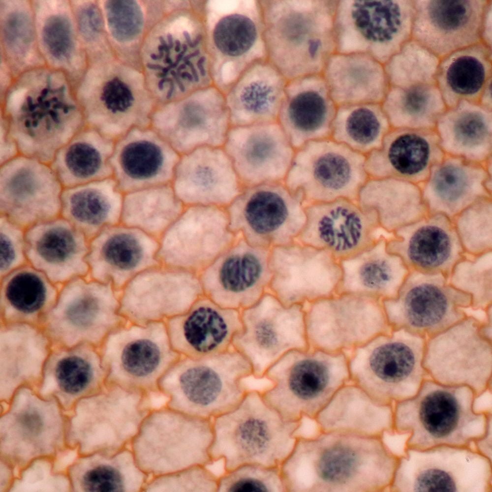 Mitosis Onion Root Tip Slides