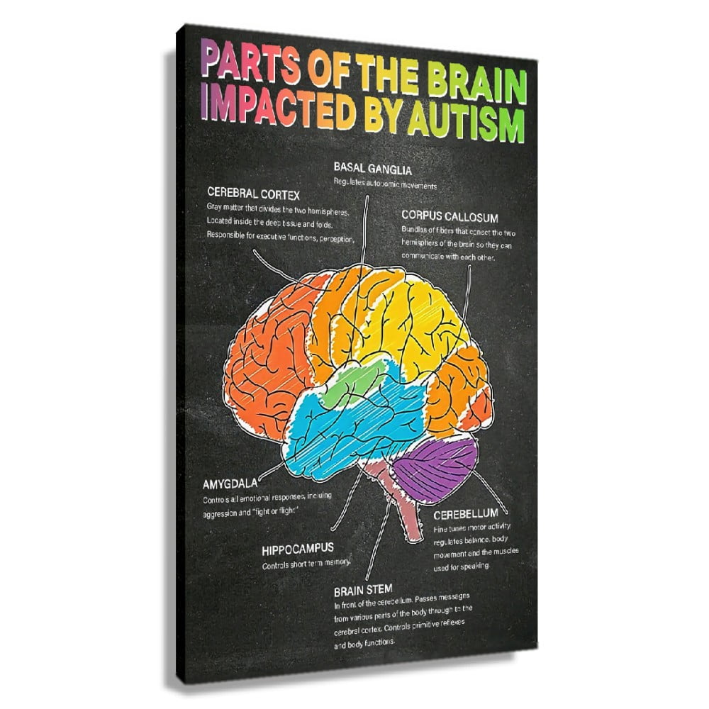 Brain Knowledge Poster Educational Wall Art Infographic Poster Pictures ...