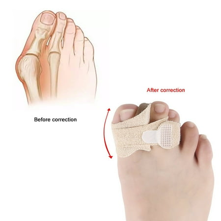 Hammer Toe Straightener Toe Wraps Splint To Realign Hammer Toe ...