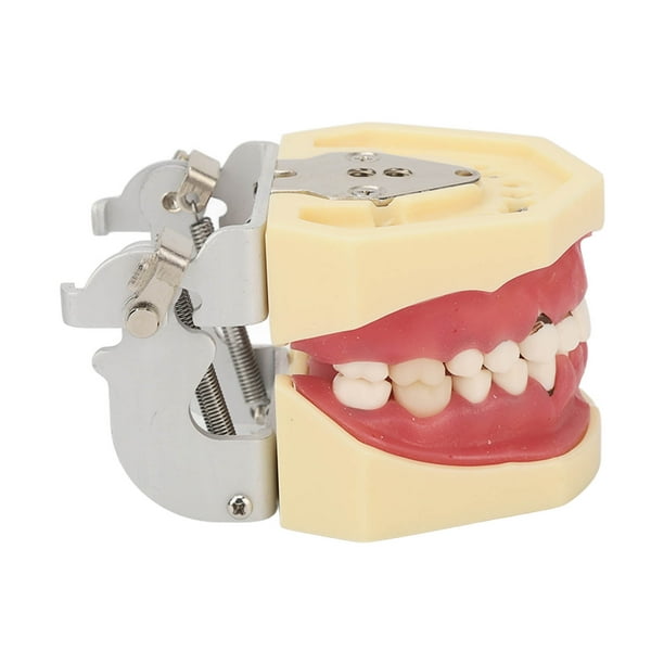 Demonstration Denture Model, Display Resin Studying Periodontal Disease ...