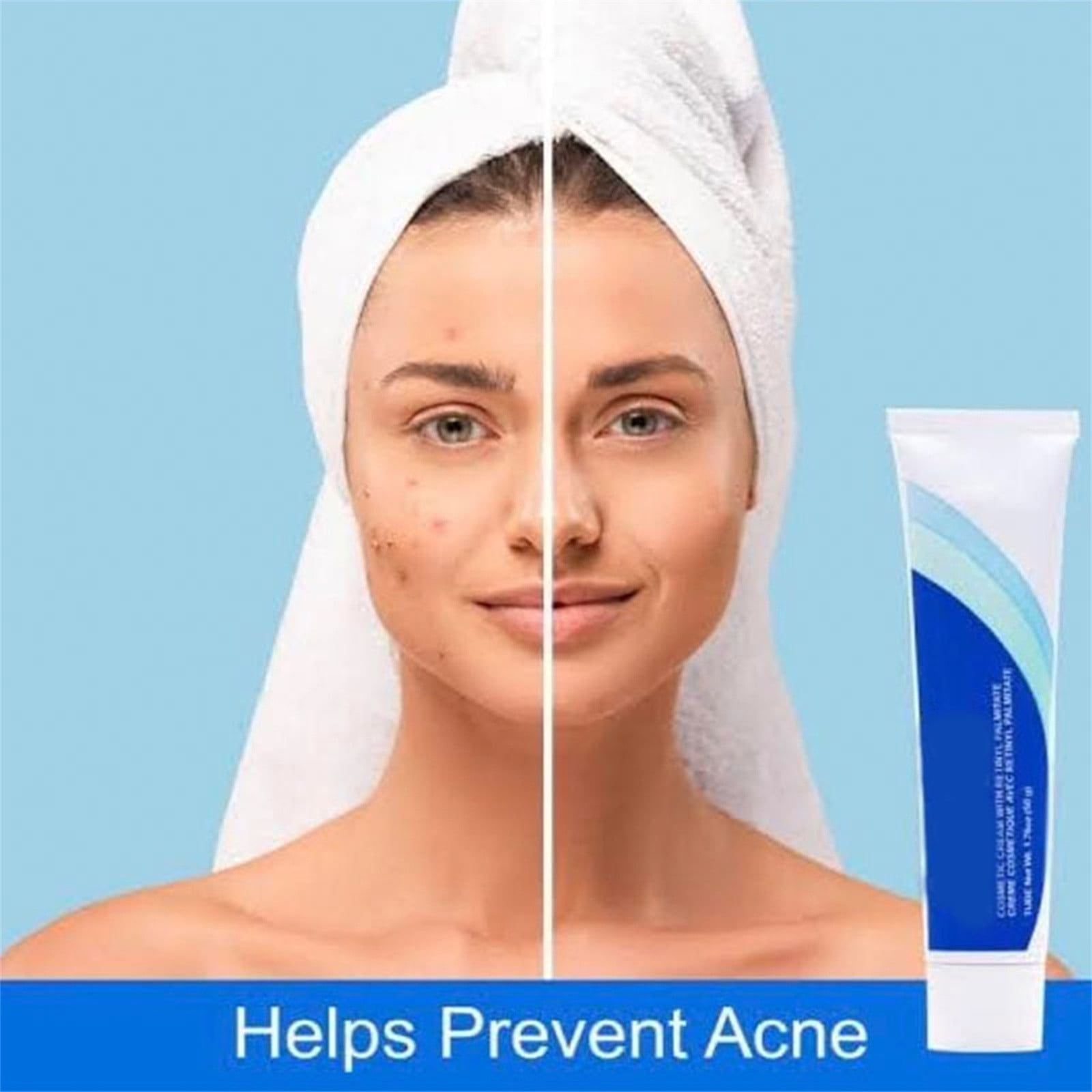 Retinol Pommade Anti Aging Night Cream, The Pore Cleansing Skin Cream ...