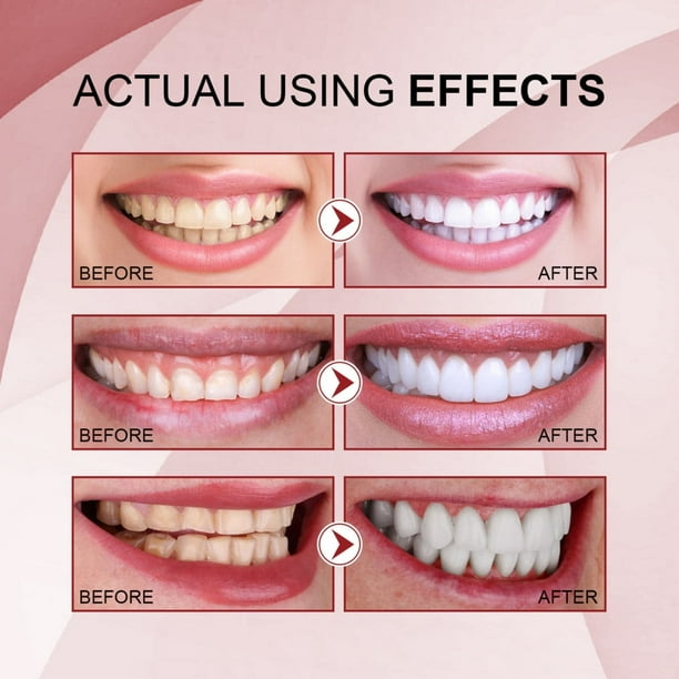 Dents Éclaircissant Taches Enlever Dentifrice Polyvalent Brillant Blanc ...