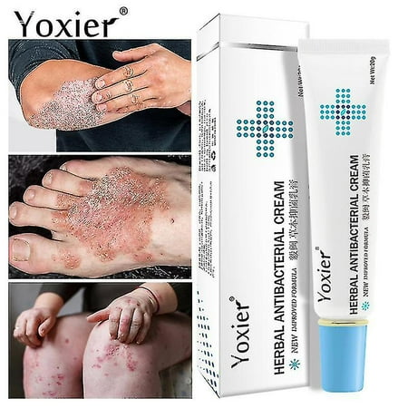 20g Herbal Antibacterial Cream Psoriasis Cream Anti-itch Relief Eczema ...